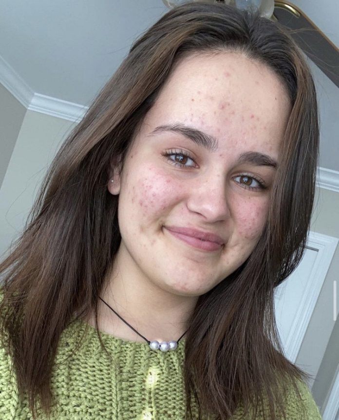 FOREHEAD, FIVE HEAD, SIX HEAD, SEVEN… | The Howler Monkey